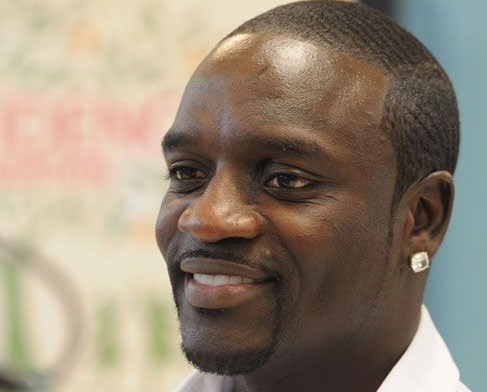 Akons Haaransatz: Er zahlte $7500 für eine Haartransplantation – Hair System