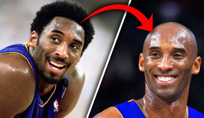 27 Best Balding NBA Players and Why Do They Loss Hair? - Hair System