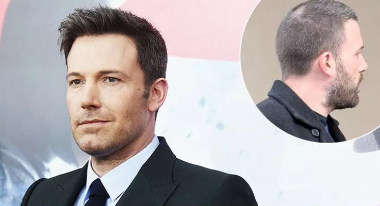 Ben Affleck Hair: Is He Bald or Wearing a Toupee? - Hair System