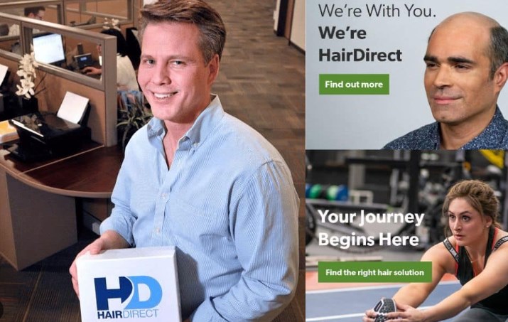 How to Cope With Hair Loss Without Hair Direct? - Hair System