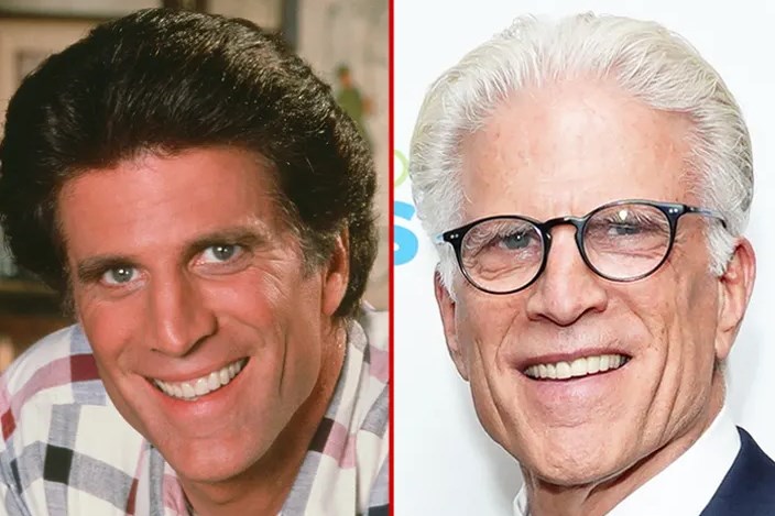 The Transformation Of Ted Danson's Hair - Hair System