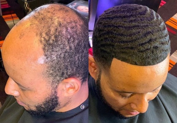 Reasons For Men Wearing Weaves and 2 Best Picks - Hair System