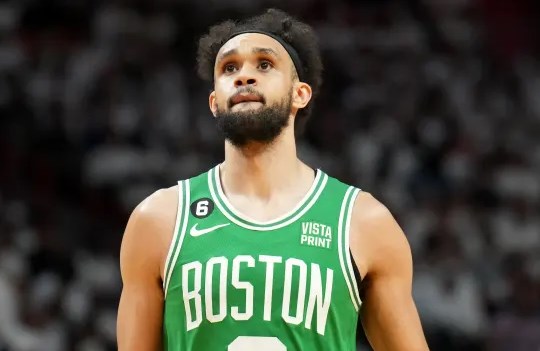 Derrick White: The Surprising New Bald Look! - Hair System