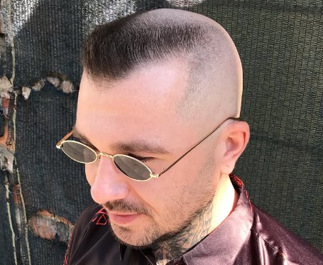 15 tagli di capelli per la corona calvizie maschile - Sistema capillare