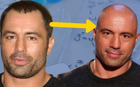 The Story Behind Joe Rogan's Hair Transplant - Hair System